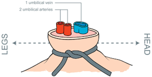 Reanimação neonatal | Pedipedia - Enciclopédia Pediátrica Online